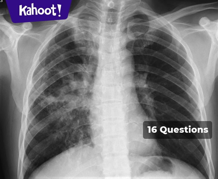 Y8 Respiratory System - Kahoot! Quiz