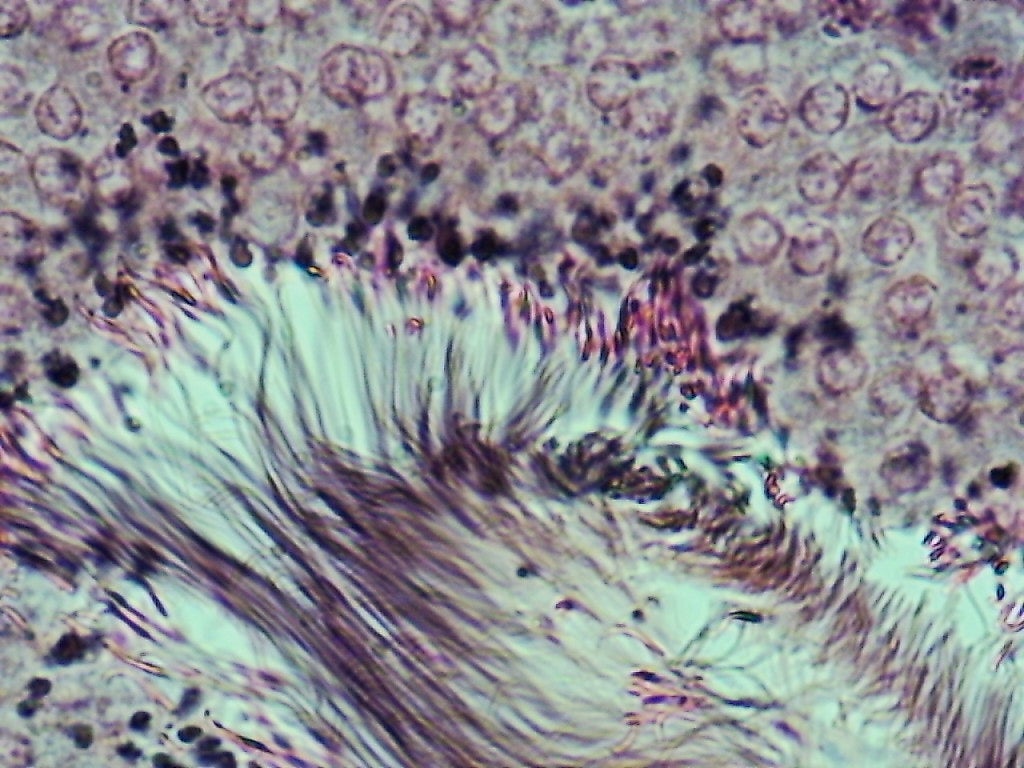 Reproductive/Endocrine - Kahoot! Quiz