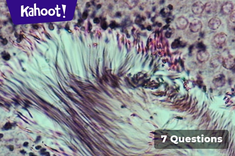 Reproductive/Endocrine - Kahoot! Quiz