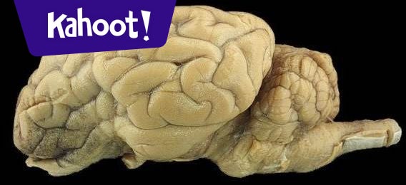 Brain Anatomy Review - Kahoot! Quiz