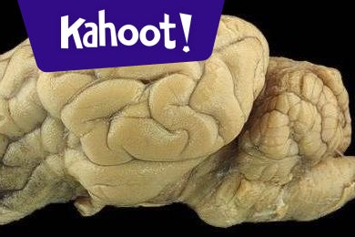 Brain Anatomy Review - Kahoot! Quiz