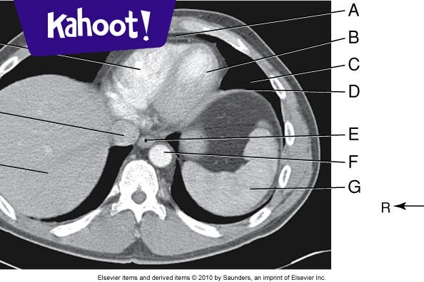 Cross sectional anatomy - Kahoot! Quiz