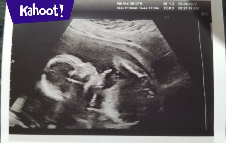 Baby Yates - Kahoot! Quiz