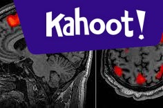 Tools for Examining the Brain - Kahoot! Quiz