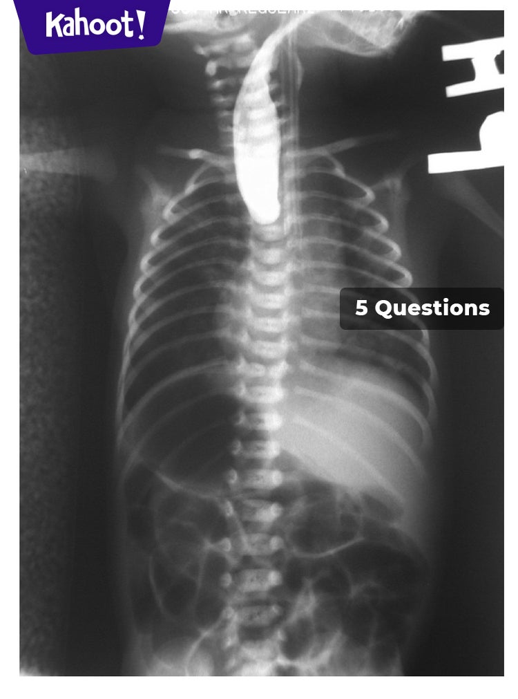 Anatomy Practical Exam 5 (Part 7) - Kahoot! Quiz
