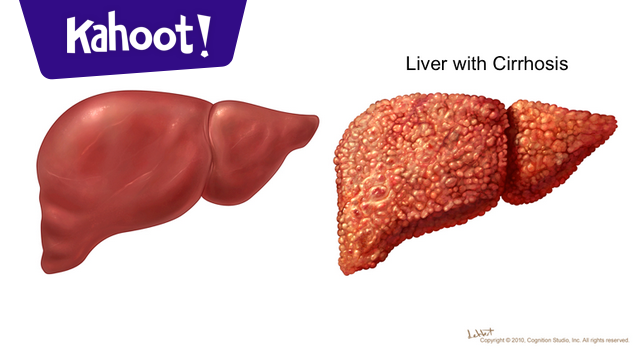 Alcohol Awareness - Kahoot! Quiz