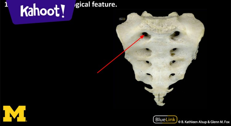 Anatomy Practical Exam 5 (Part 6) - Kahoot! Quiz