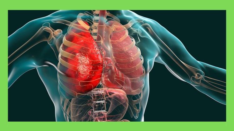 IB Biology B3: Gas exchange, transport, muscles and movement - Kahoot ...