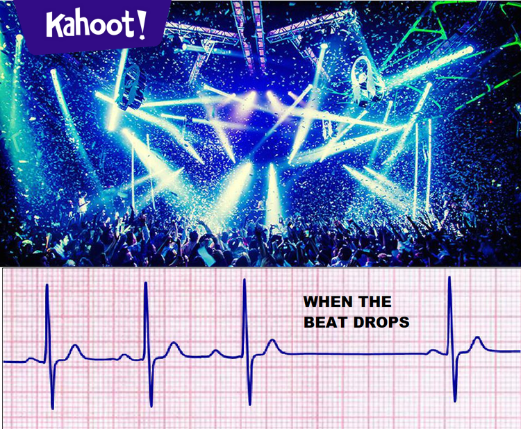 Patho Phys Cardiac Module 3 B Ekg S Kahoot Quiz