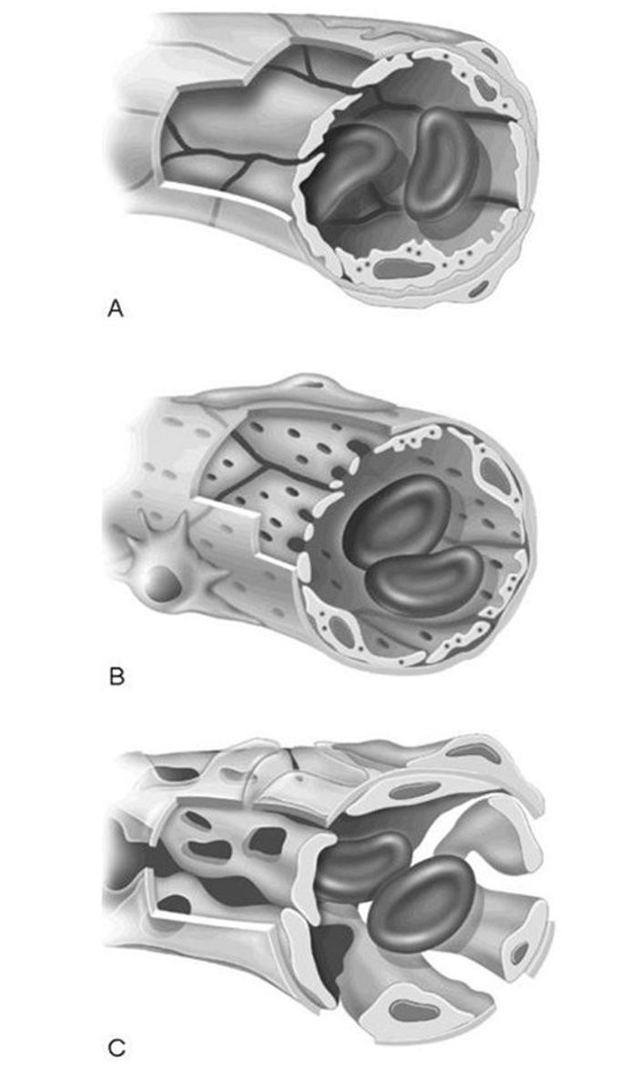 Chapter 18 Review (Blood Vessels I + II) - Kahoot! Quiz