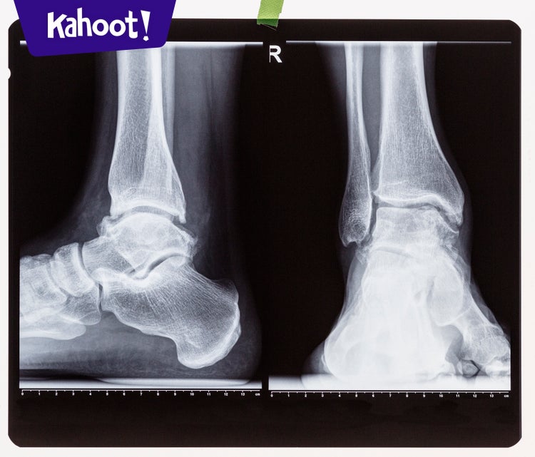 Systemic Pathology - Bone Pathology Part I - Kahoot! Quiz