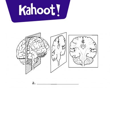 Unit 1 Anatomical Terms & Organ Systems - Kahoot! Quiz