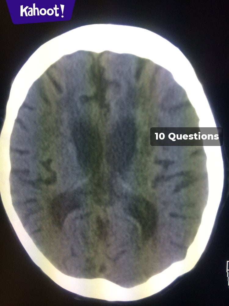 Senior Medicine Radiology - Kahoot! Quiz