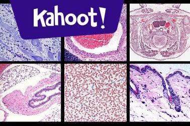 Histology (Epithelial, Connective and Muscular Tissues) - Kahoot! Quiz