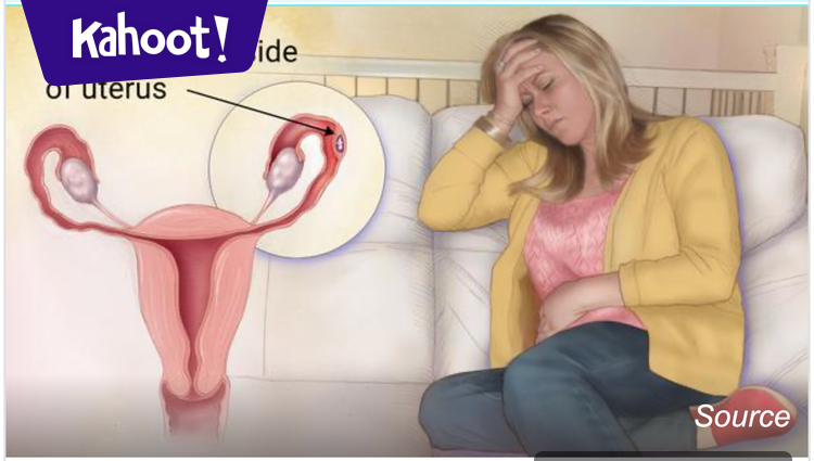 Reproduction System And Disorders Kahoot Quiz