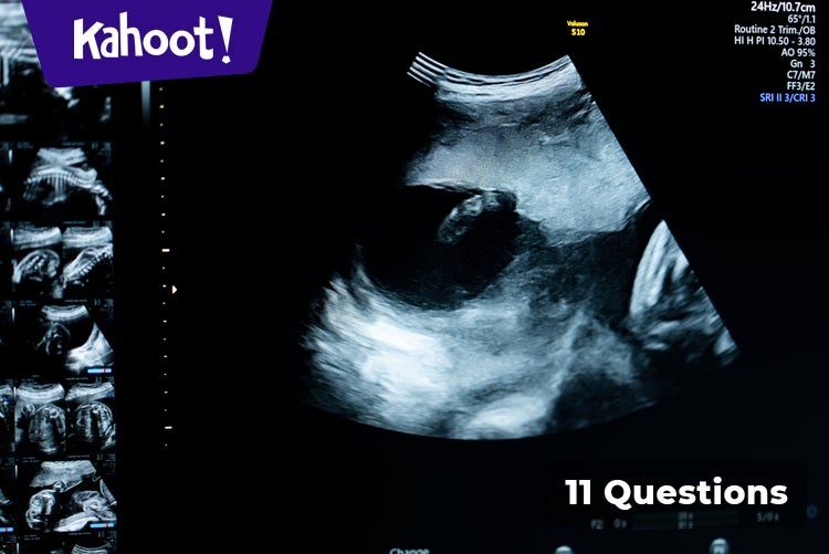 What Is Medical Imaging? Part 2 - Kahoot! Quiz