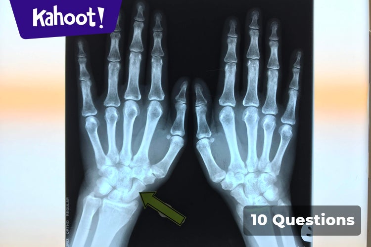 PA Week 127 - Elbow and hand - Kahoot! Quiz
