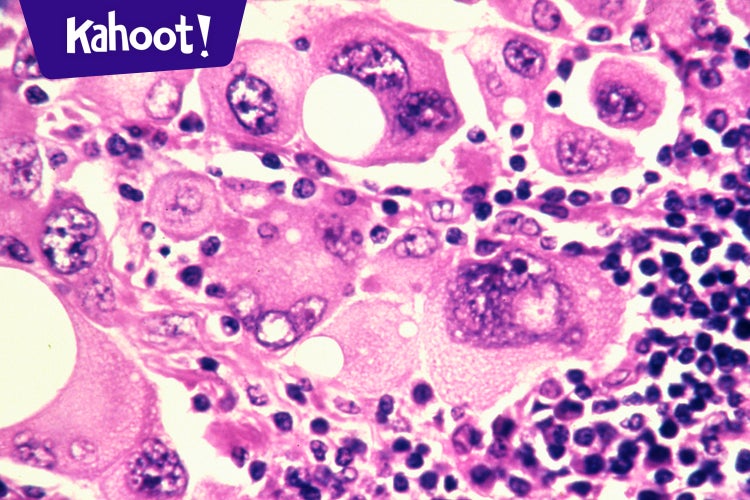 BIO1410: the Integumentary System - Kahoot! Quiz
