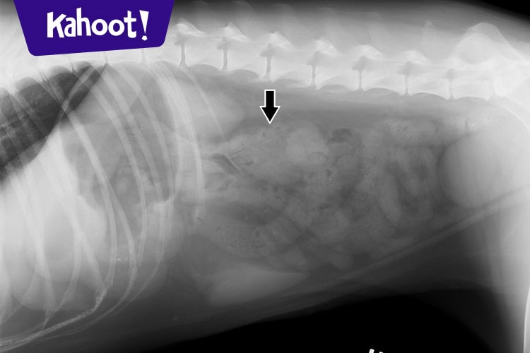 2.1 Describe the Properties and Effects of Radiation: Types of Contrast ...