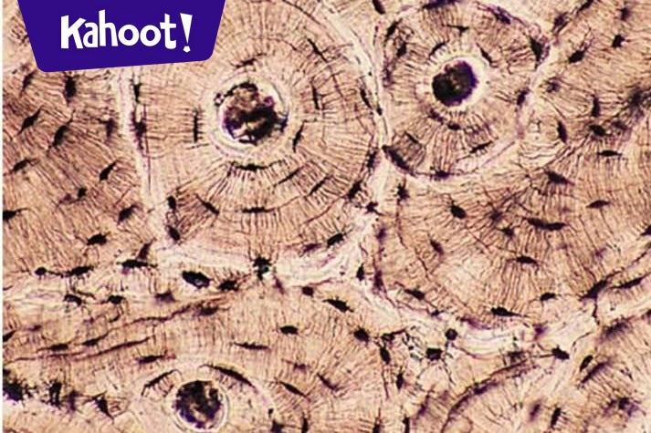 Chp 6: Bone Tissue - Kahoot! Quiz
