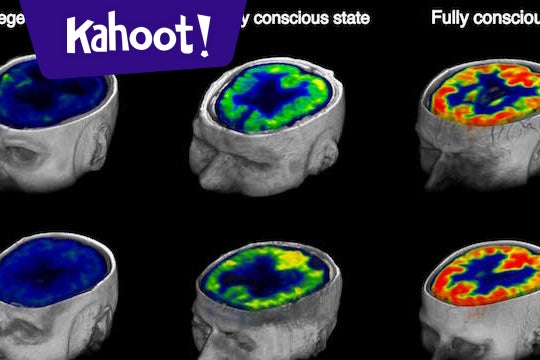 PET Scan Review - Kahoot! Quiz